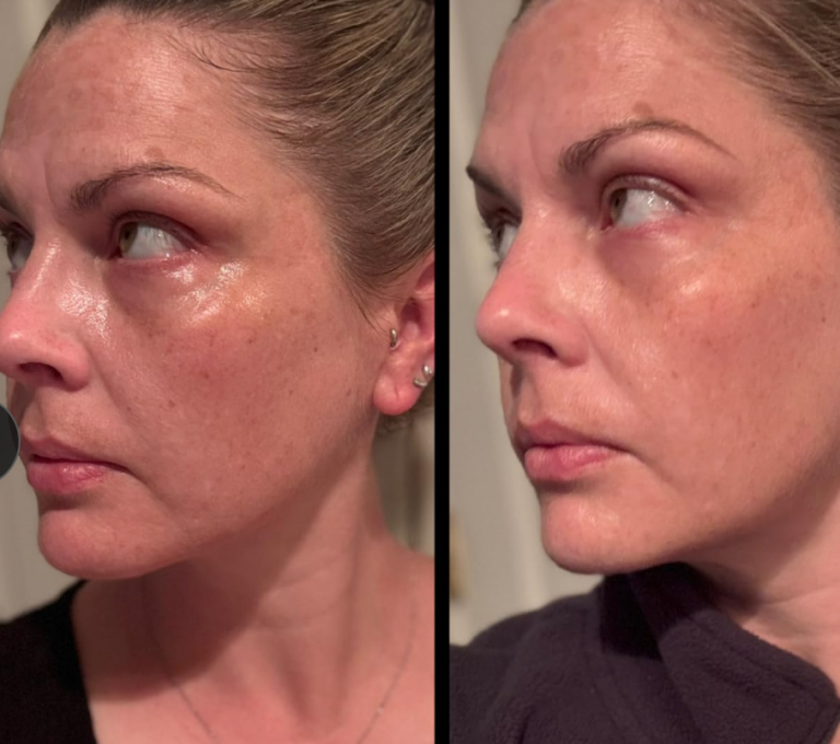 I bought Seranova Micro Infusion: here's my unbiased review! - Snoopviews